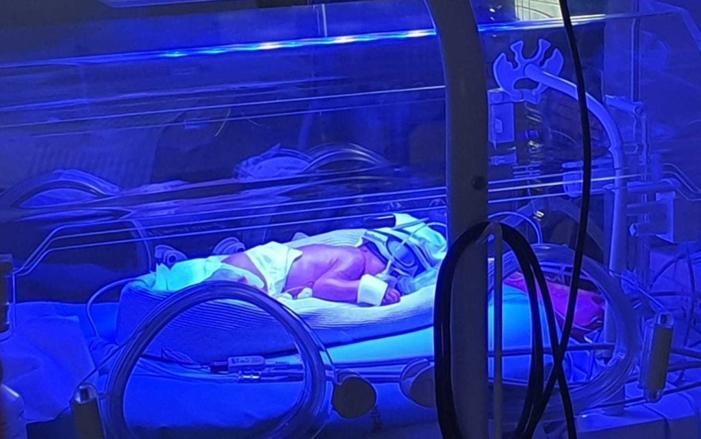 Le programme NIDCAP - Petit mais costaud